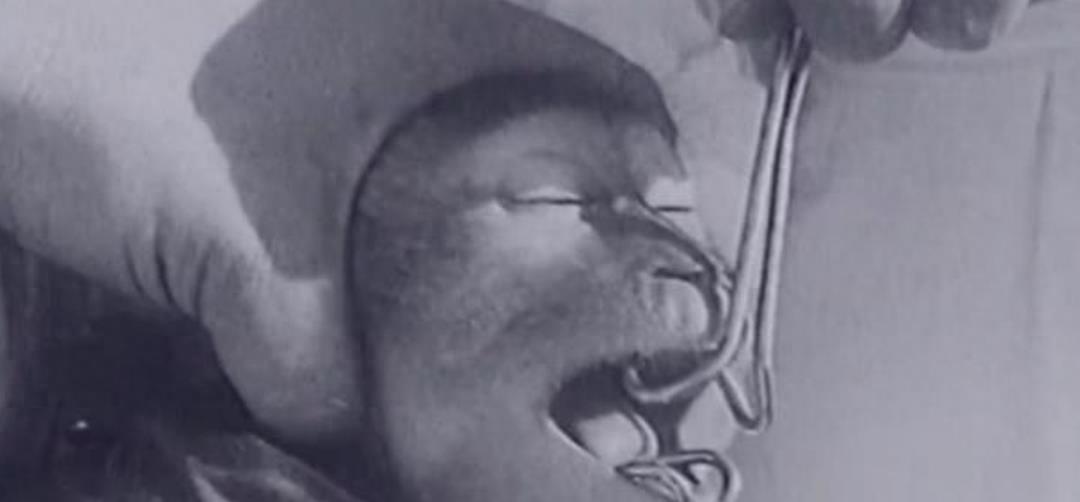 Soviet scientists' inhumane experiments: trying to make "human-ape ...