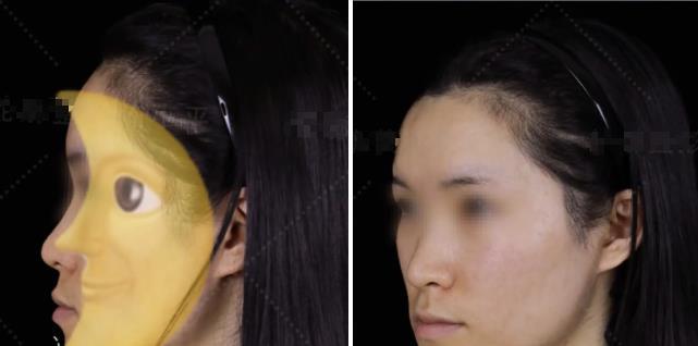 The moon face is the killer of beauty, and the bitter look looks like a ...