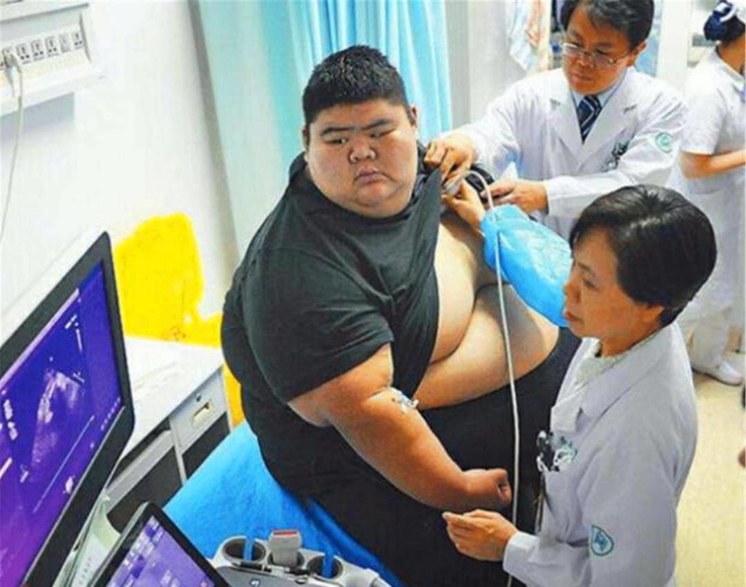 Wang Haonan, the fattest person in China, lost 480 pounds for love ...