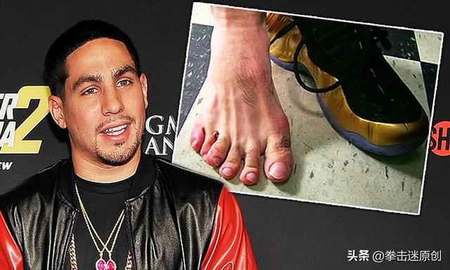 "Six-toed boxer" will return tomorrow, hoping to fight Spence at 154 ...