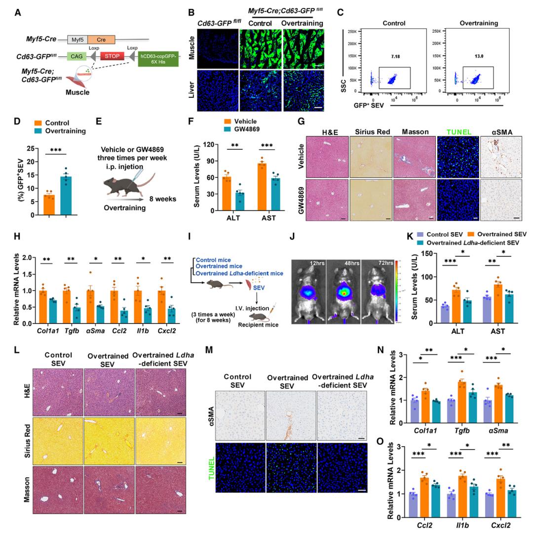 Cell Metab: Excessive exercise may seriously damage liver health and ...