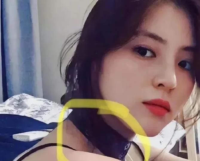 The truth about Han Su Hee's plastic surgery is revealed! Chaebol ...