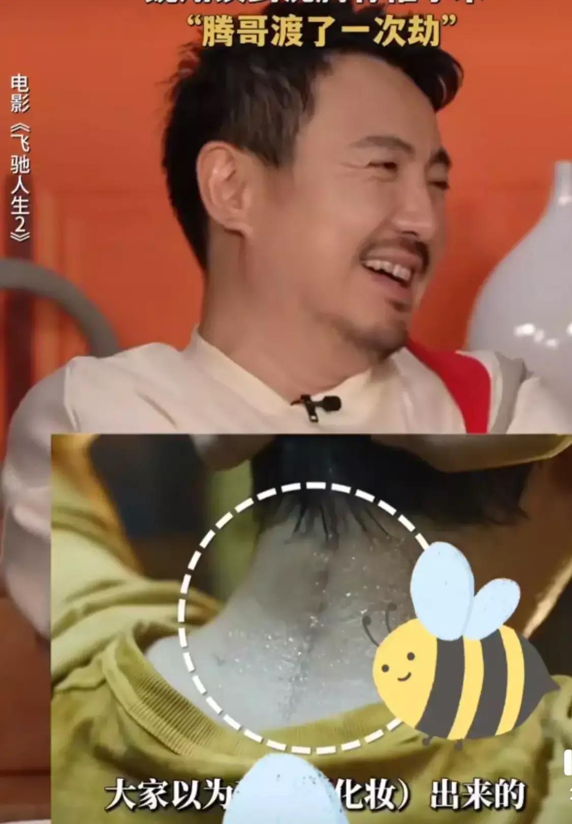 Shen Teng appears in the new movie "Flying Life 2" with obvious scars ...