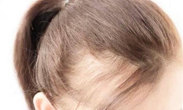 If you have this feature on your hair, you may not be a pure Han ...