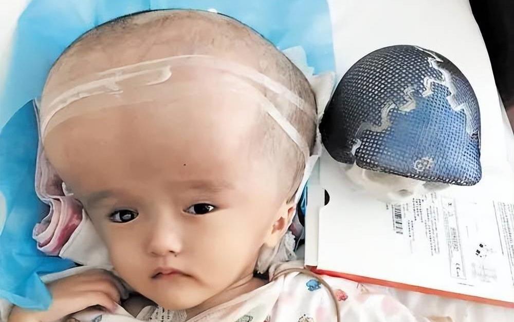 15 years later, the boss of "Sanlu Milk Powder" who poisoned more than ...