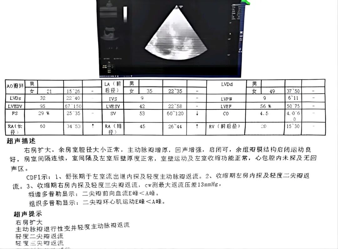Key points of preoperative anesthesia evaluation and anesthesia ...