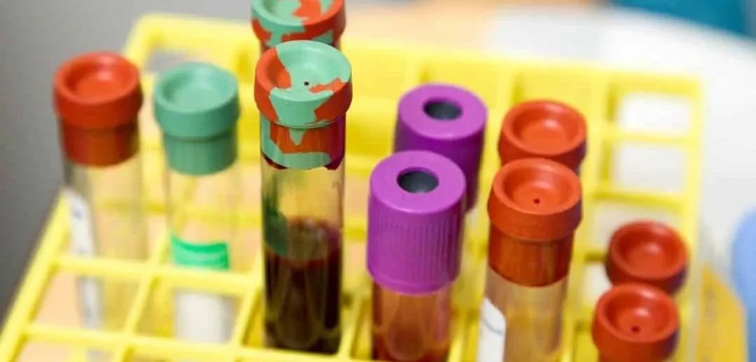 How can "blood routine" break the routine? New progress in Nature - iMedia