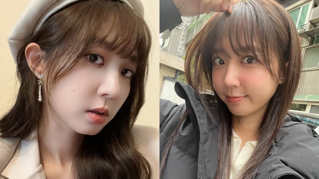 Hong Shi was shocked to find out about "corneal erosion" during her ...