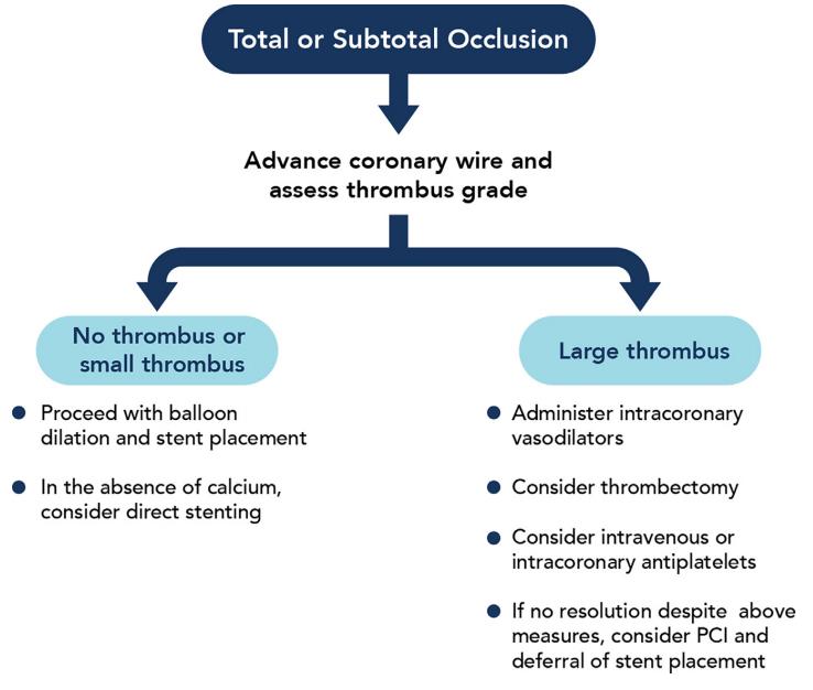 How should STEMI patients undergo emergency PCI? See what the latest ...
