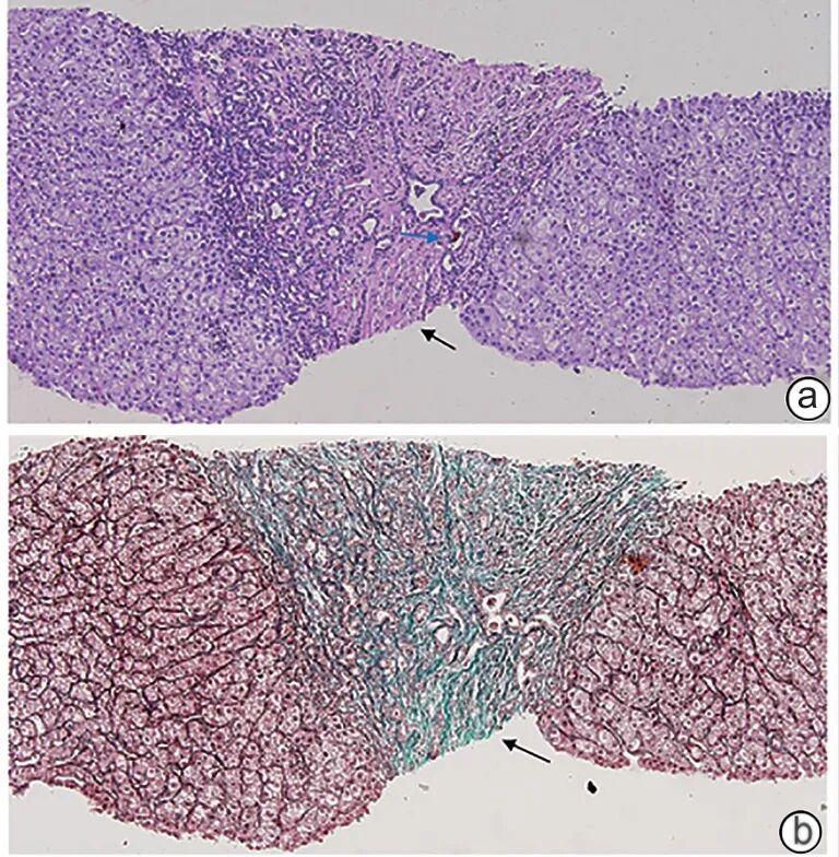 Analysis of the clinical and pathological characteristics of patients ...